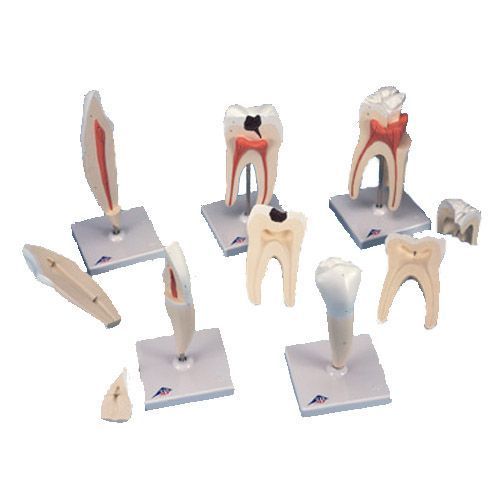 Set of 5 tooth models D10 for €481.20 in Human teeth model